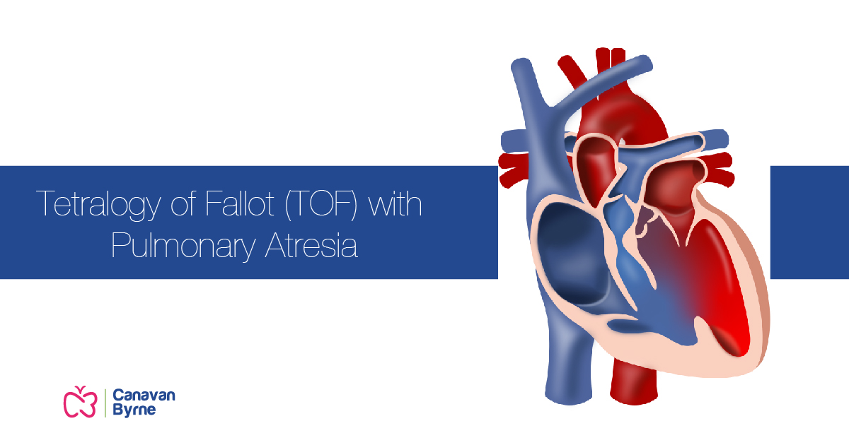 Tetralogy of Fallot (TOF) Care Plan - Early Years Shop